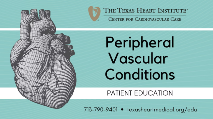 Perifere vaatziekte | Het Texas Heart Institute®