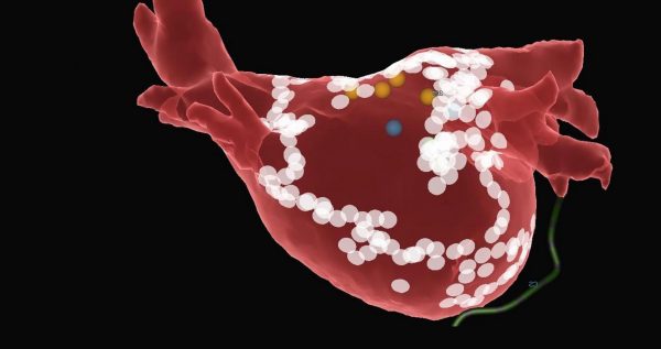 Science features liquid electrodes | The Texas Heart Institute®