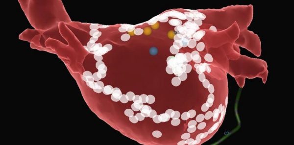 Cardiovascular Research | The Texas Heart Institute®