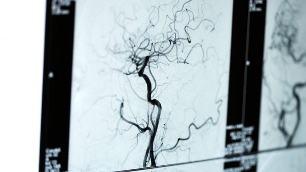 What is a Cardiovascular Radiologist? | The Texas Heart Institute®