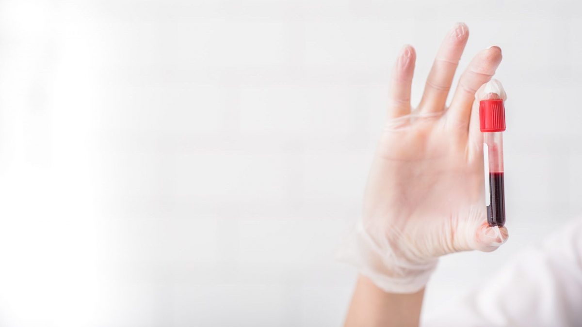 Doris A. Taylor Archives | The Texas Heart Institute®