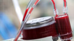 What is a Perfusionist? | Texas Heart Institute