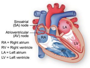 Catheter Ablation | The Texas Heart Institute®