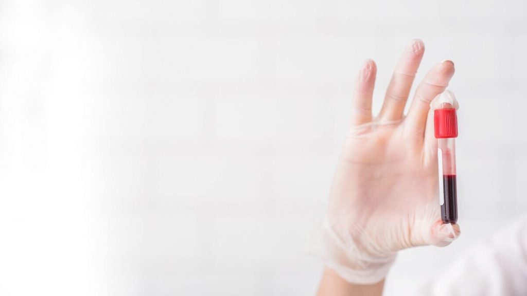 Know Your Numbers | The Texas Heart Institute®