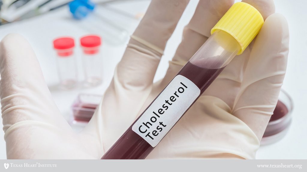 Statin, Obat Penurun Kolesterol | Institut Jantung Texas®