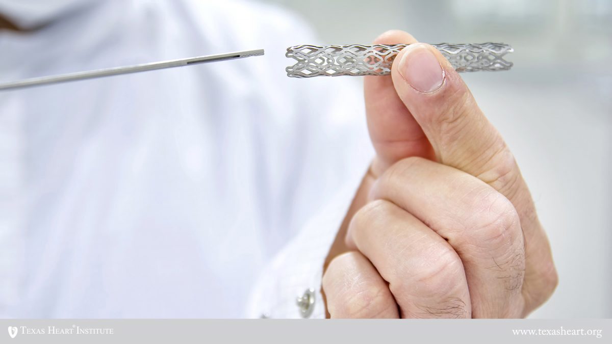 Angioplastia y colocación de stents en las arterias carótidas | The ...