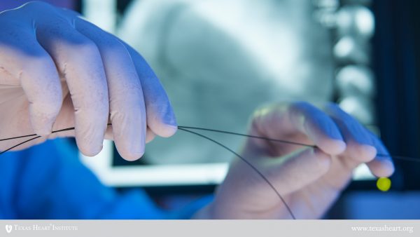 Who Needs Stents and Why? | The Texas Heart Institute®