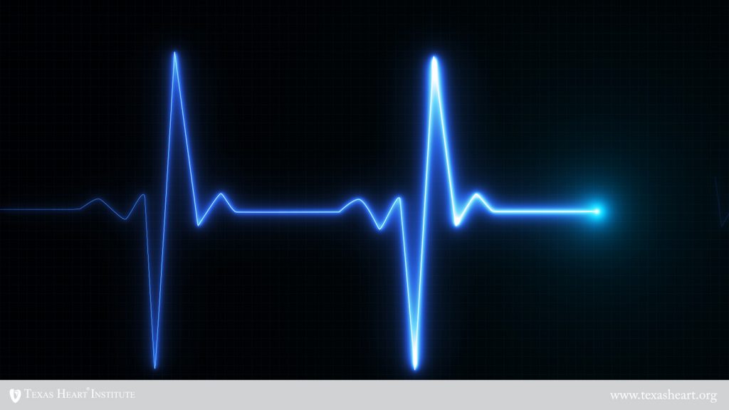 Implantable Cardioverter Defibrillator (ICD) | The Texas Heart Institute®