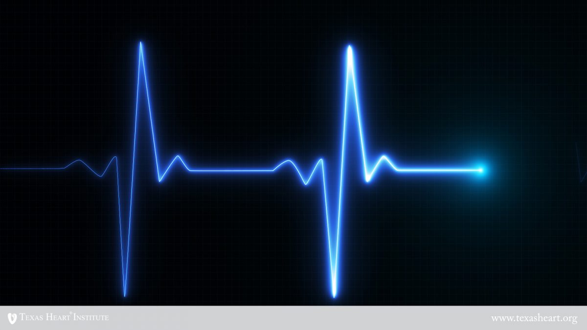 Bundle Branch Block | The Texas Heart Institute®