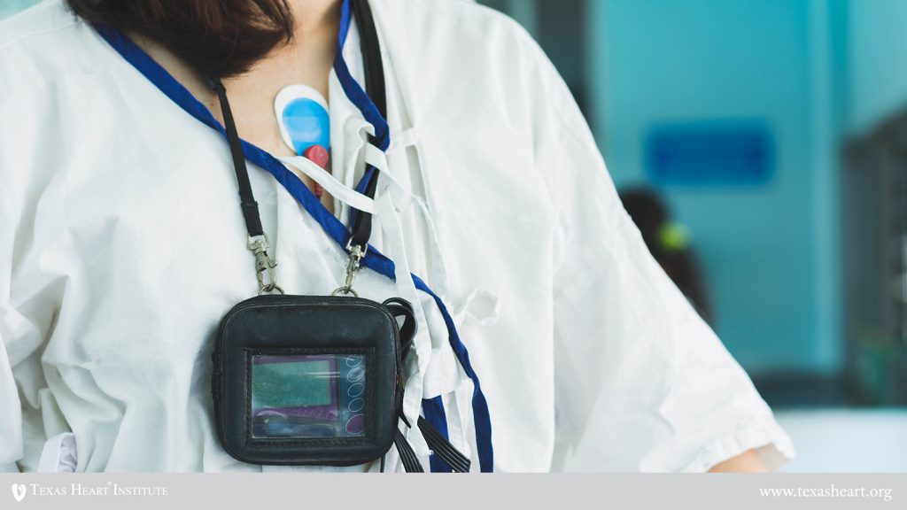 Will stressful events influence the results on my Holter monitor? | The ...