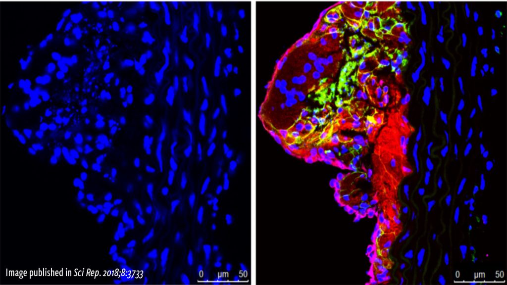 Texas Heart Institute Discovery to Enhance the Immune System Moves ...