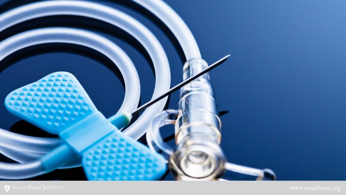 Can the Lariat procedure aggravate atrial fibrillation? | The Texas ...