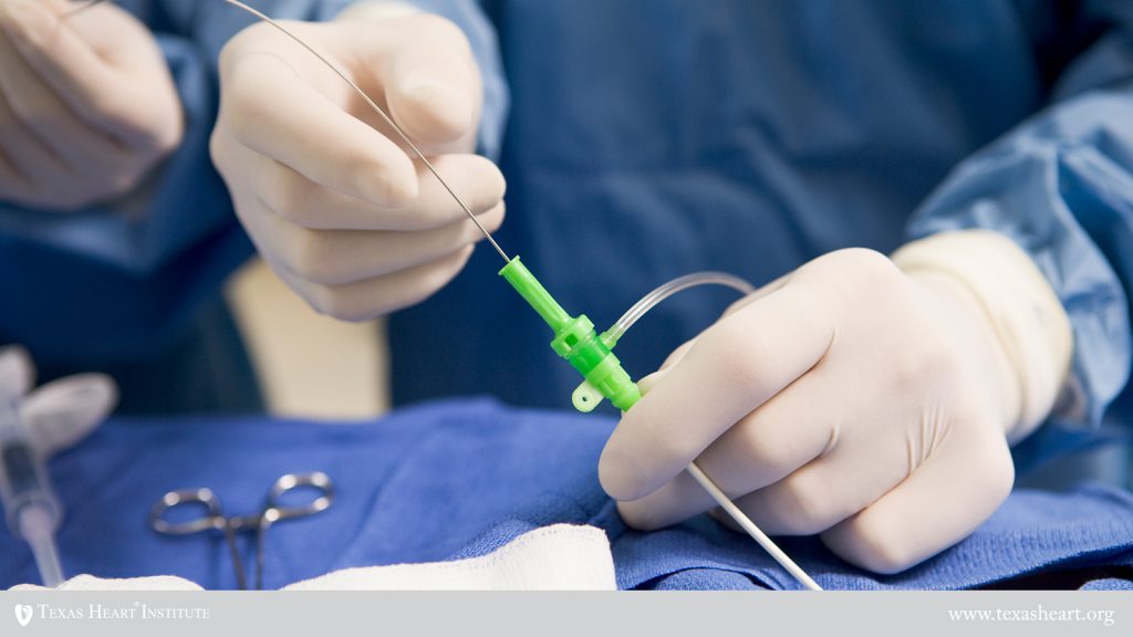 Cateterización cardíaca | The Texas Heart Institute®