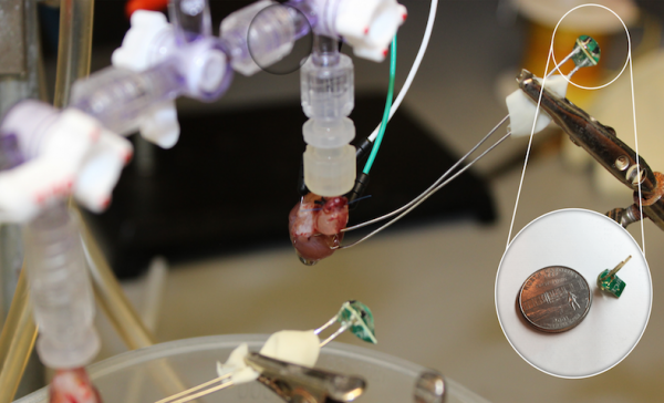 Developing New Wireless, Shockless Pacemaker Technology | The Texas ...