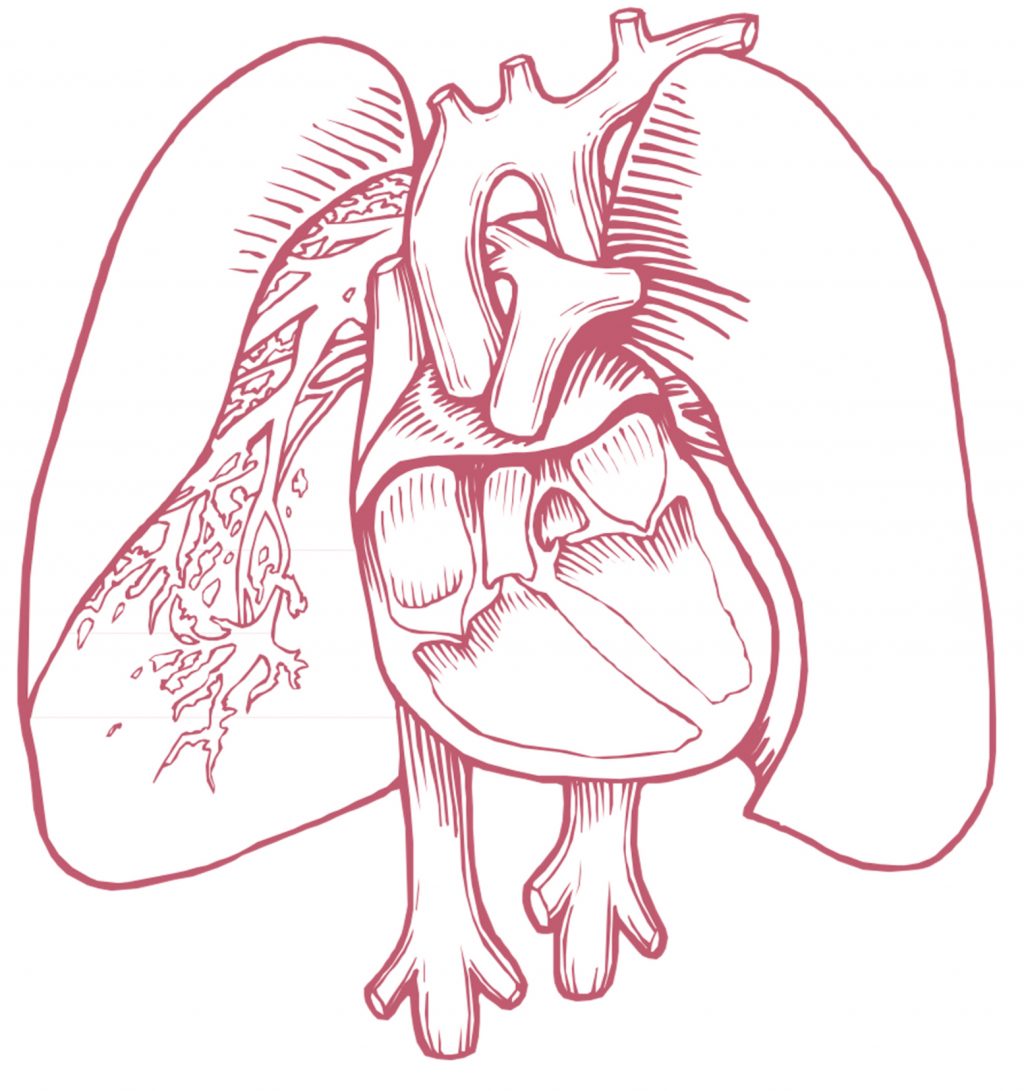 El trasplante de pulmón | Ny Texas Heart Institute®