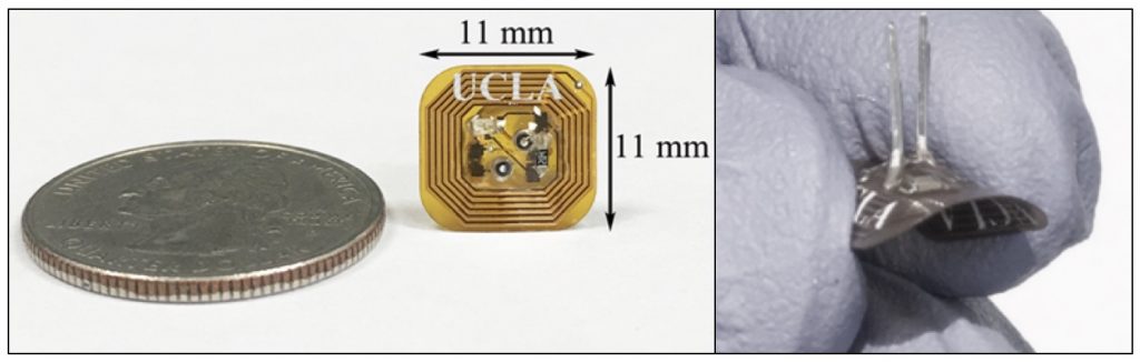 Doctors successfully synchronize both sides of the heart with promising ...