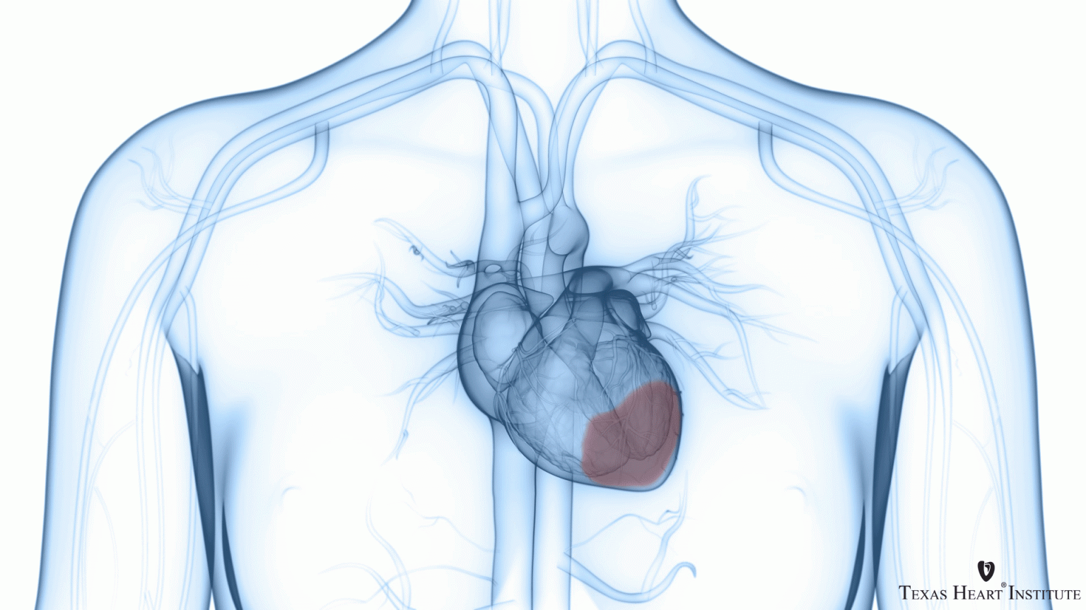 Expanding Hippo Pathway Studies From the Heart to the Head: A Novel ...