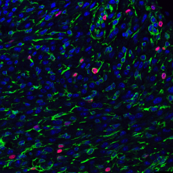 New Texas Heart Institute Study Outlines Additional Reasons for ...