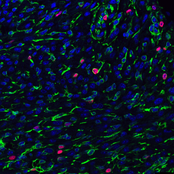 New Texas Heart Institute Study Outlines Additional Reasons for ...