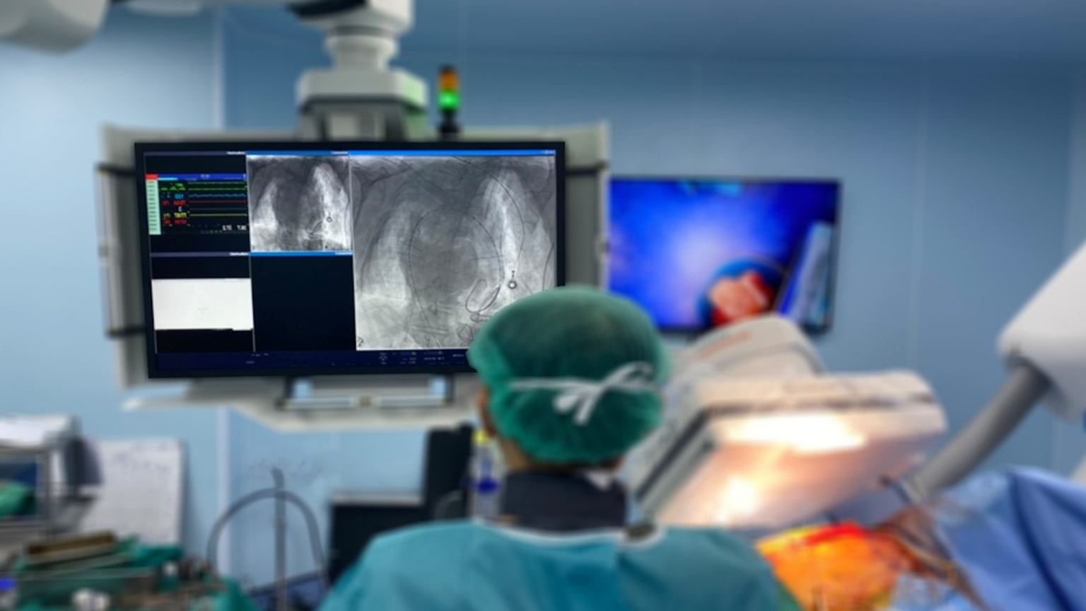 Avoiding Primary Graft Dysfunction After Lung Transplant | The Texas ...