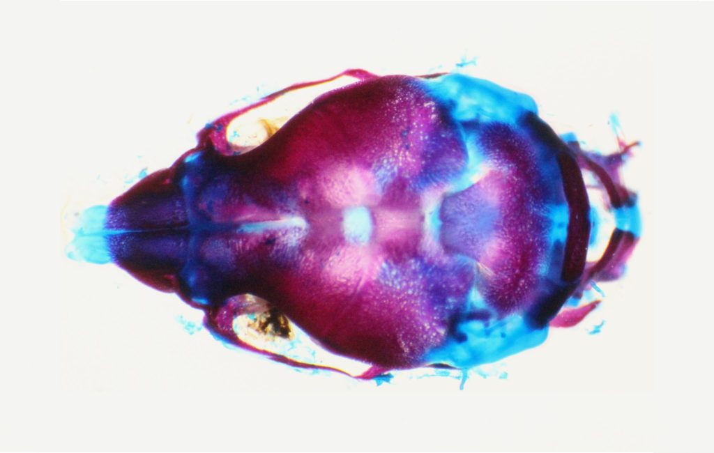 Expanding Hippo Pathway Studies From the Heart to the Head: A Novel ...
