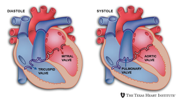 Penyakit Katup Mitral | Institut Jantung Texas®