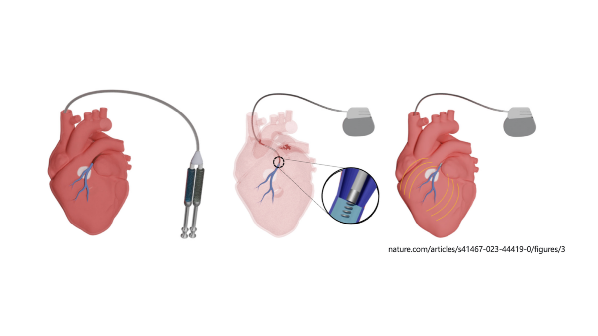 Novel Injectable Hydrogel Technology Featured in Drug Discovery News ...