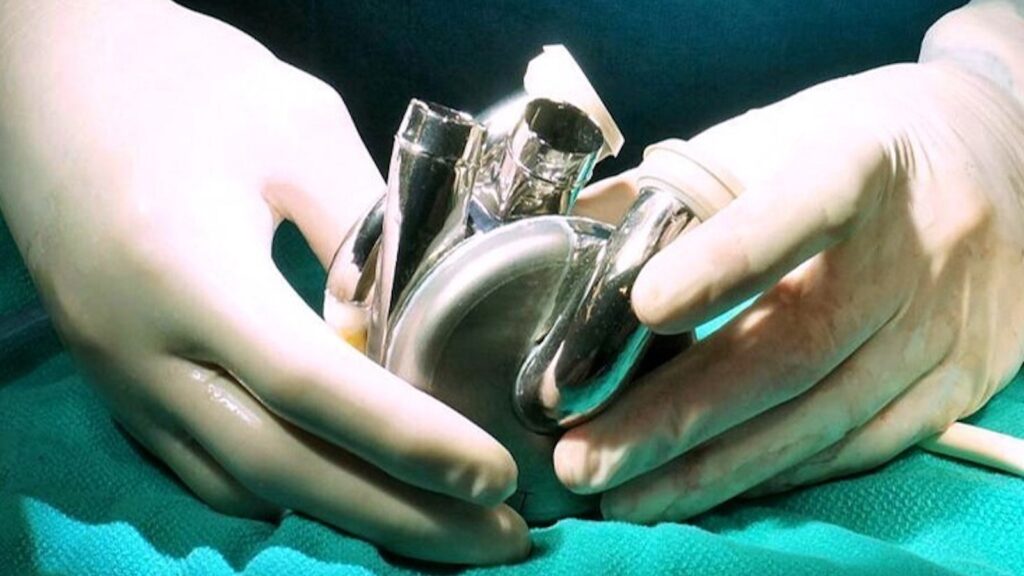 The Texas Heart Institute Implants BiVACOR® Total Artificial Heart ...