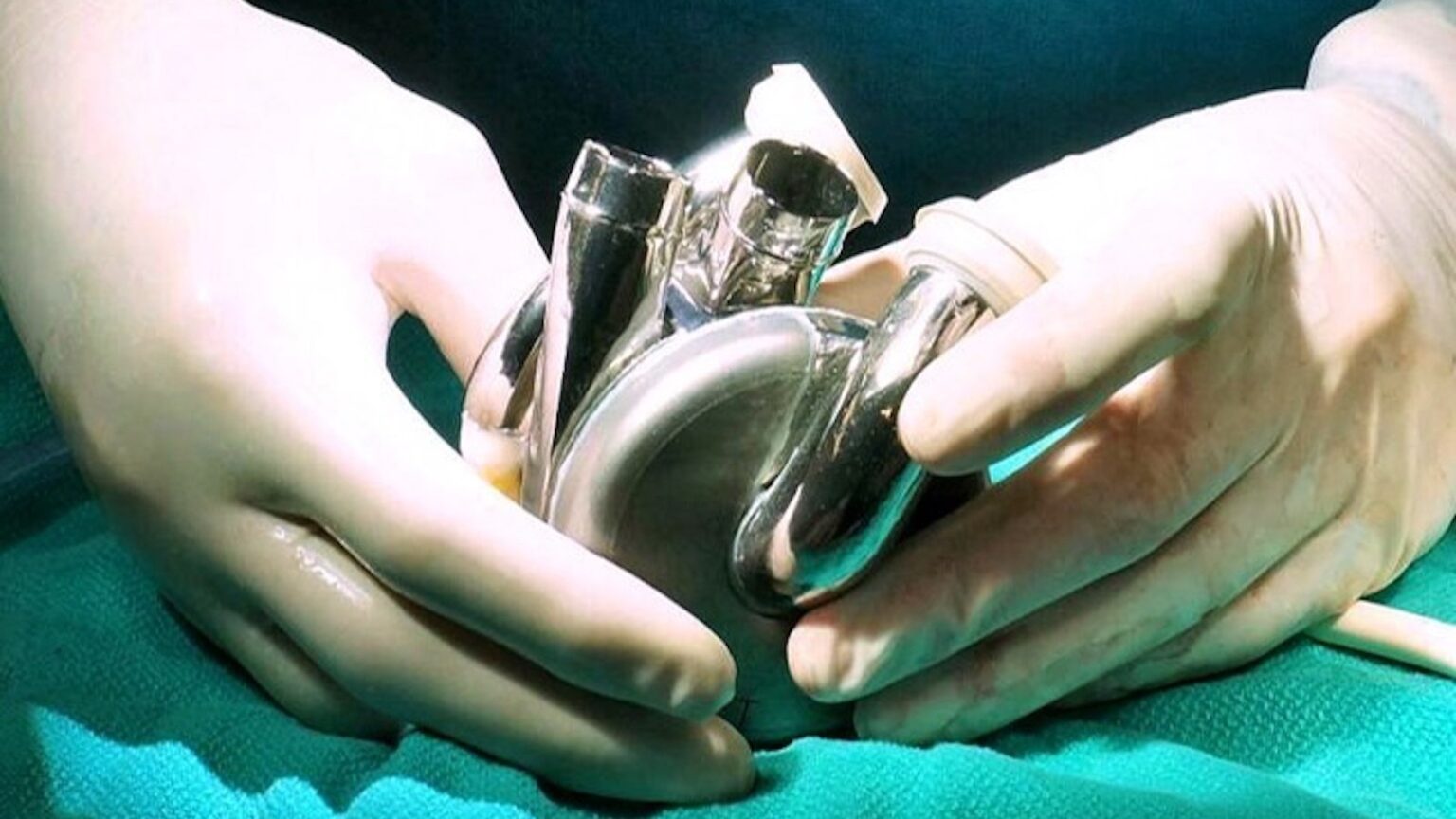 The Texas Heart Institute Implants BiVACOR® Total Artificial Heart ...