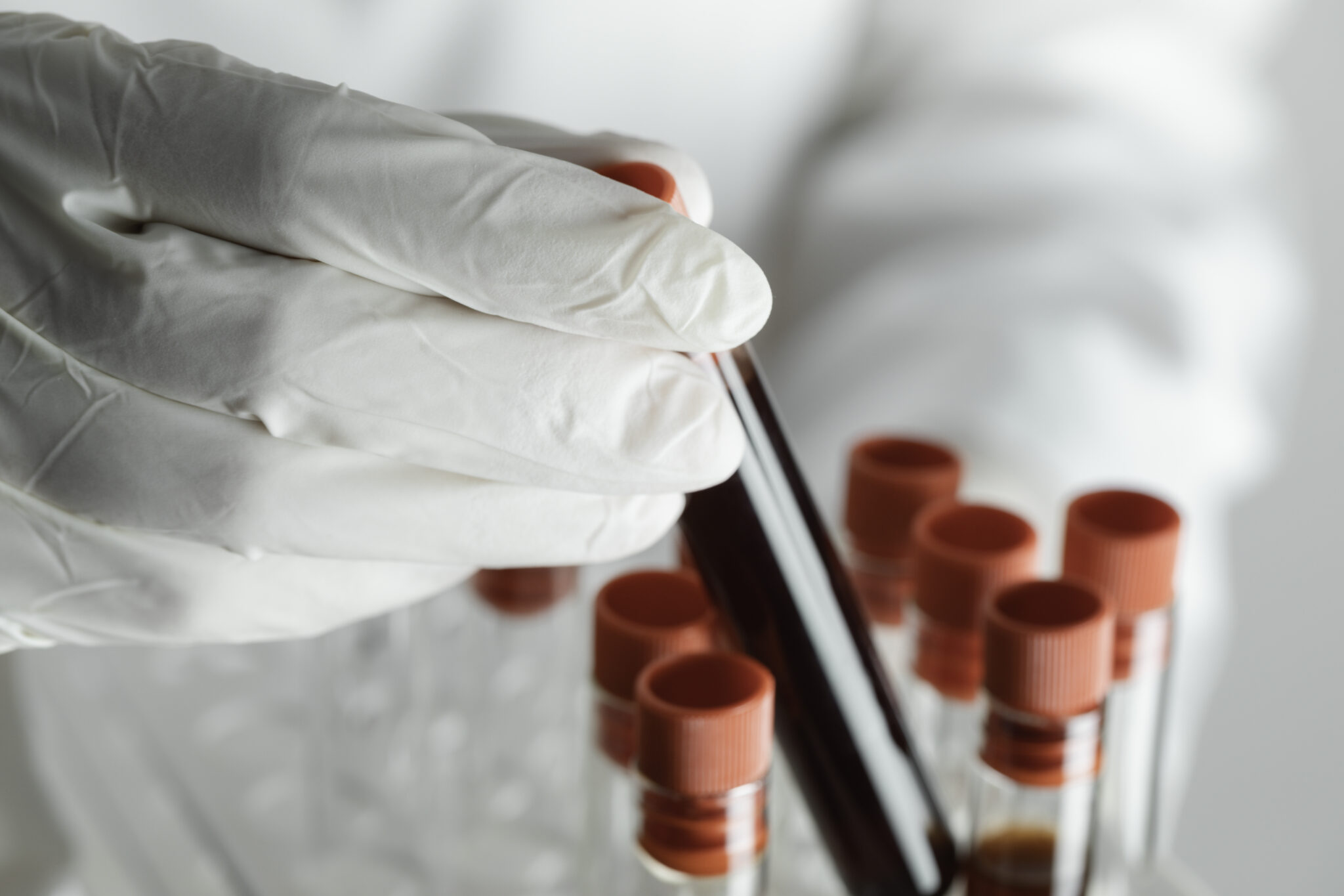 Do I have sticky blood? | The Texas Heart Institute®